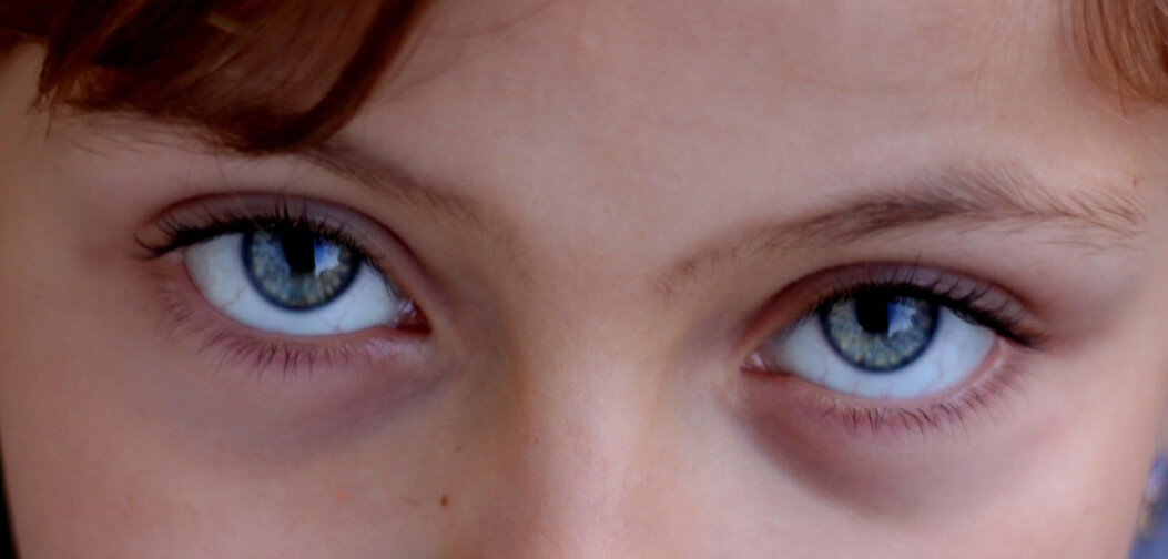 Rheuma und das Auge: Sehkraft bei Kindern und Jugendlichen effektiver ...